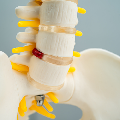 Isiász - Neurológiai Központ